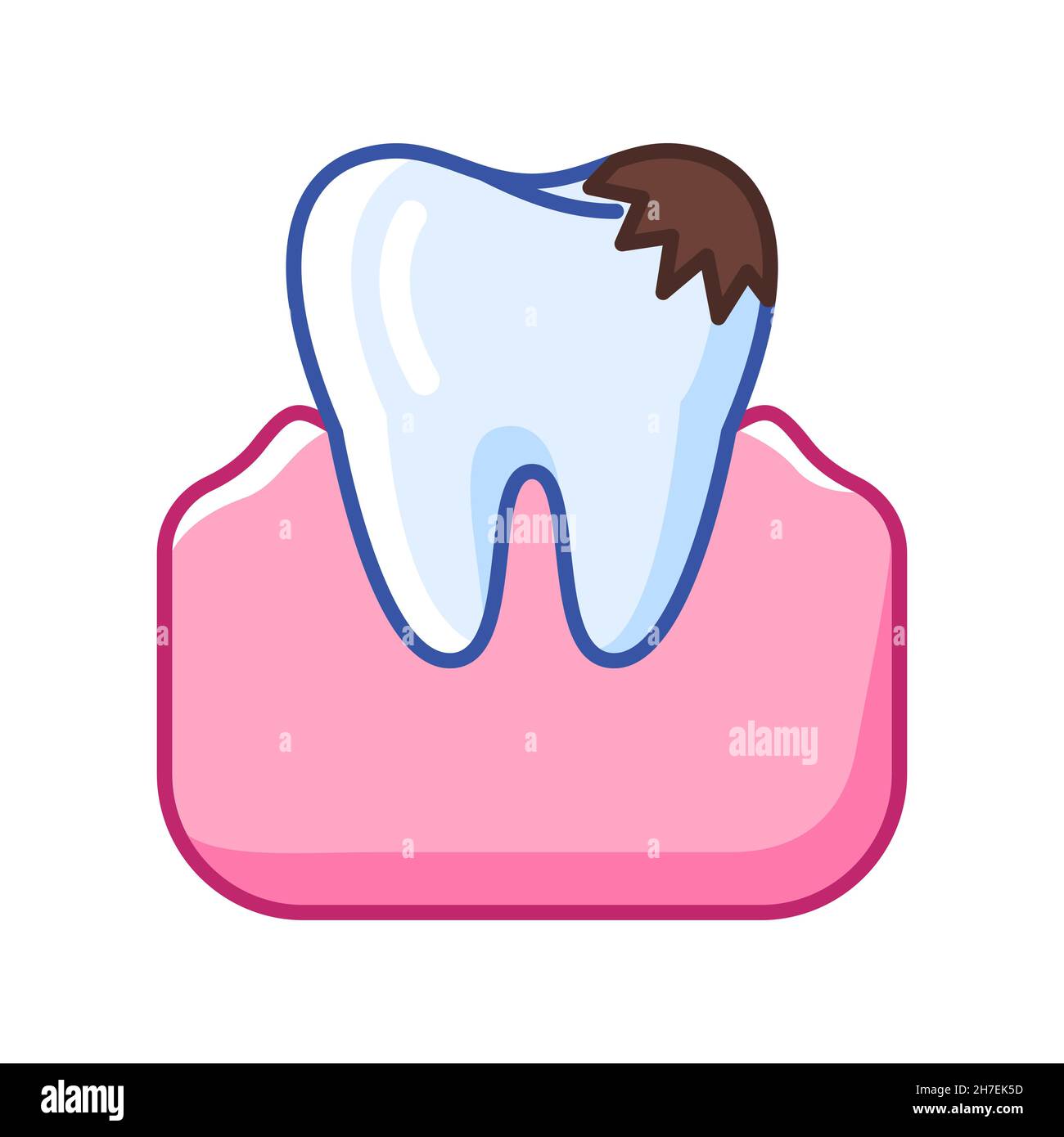 Illustration of tooth decay. Dentistry and health care icon ...