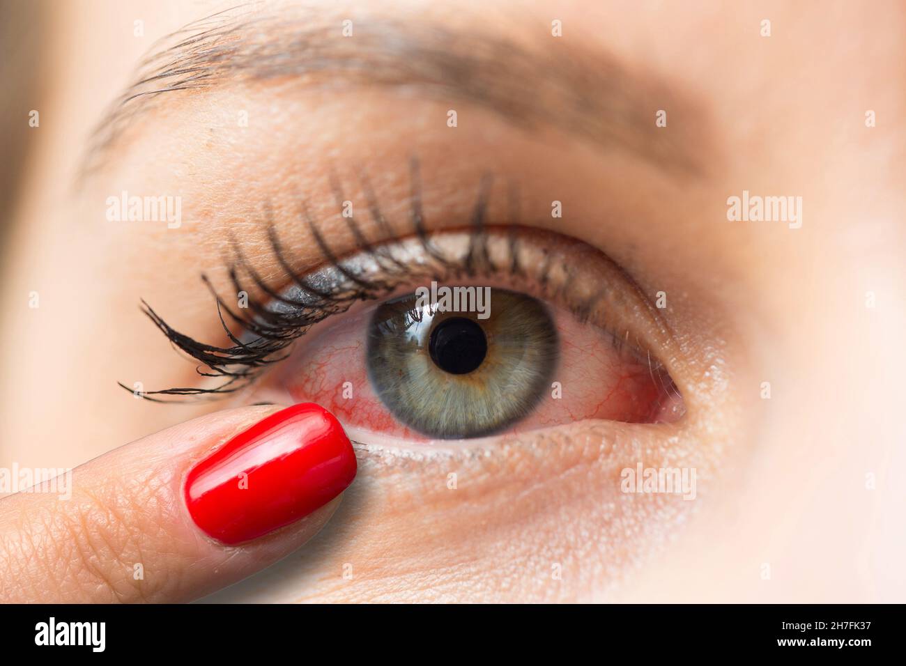Woman bloodshot eyes hi-res stock photography and images - Alamy