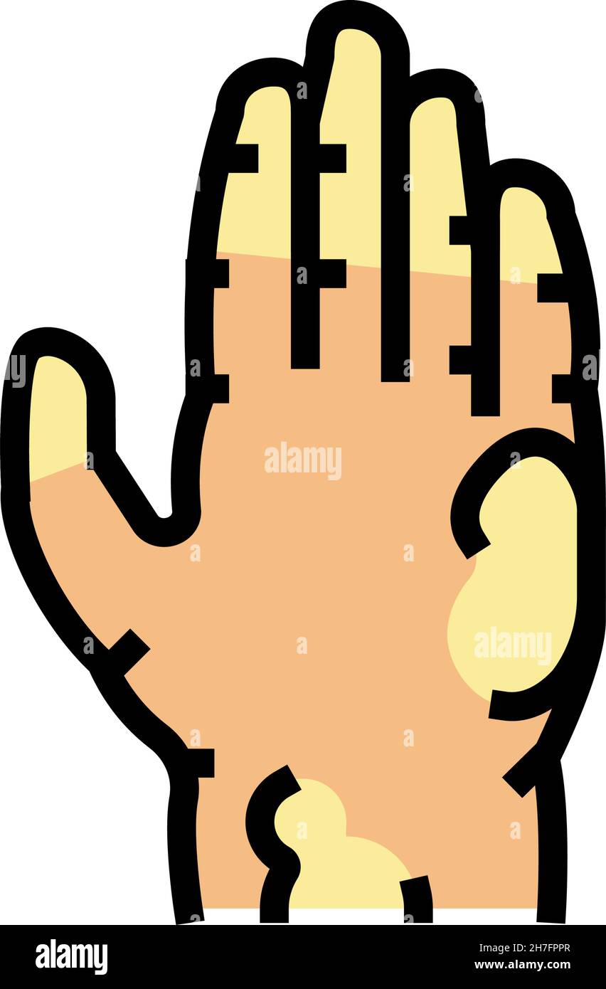 scleroderma skin disease color icon vector illustration Stock Vector ...