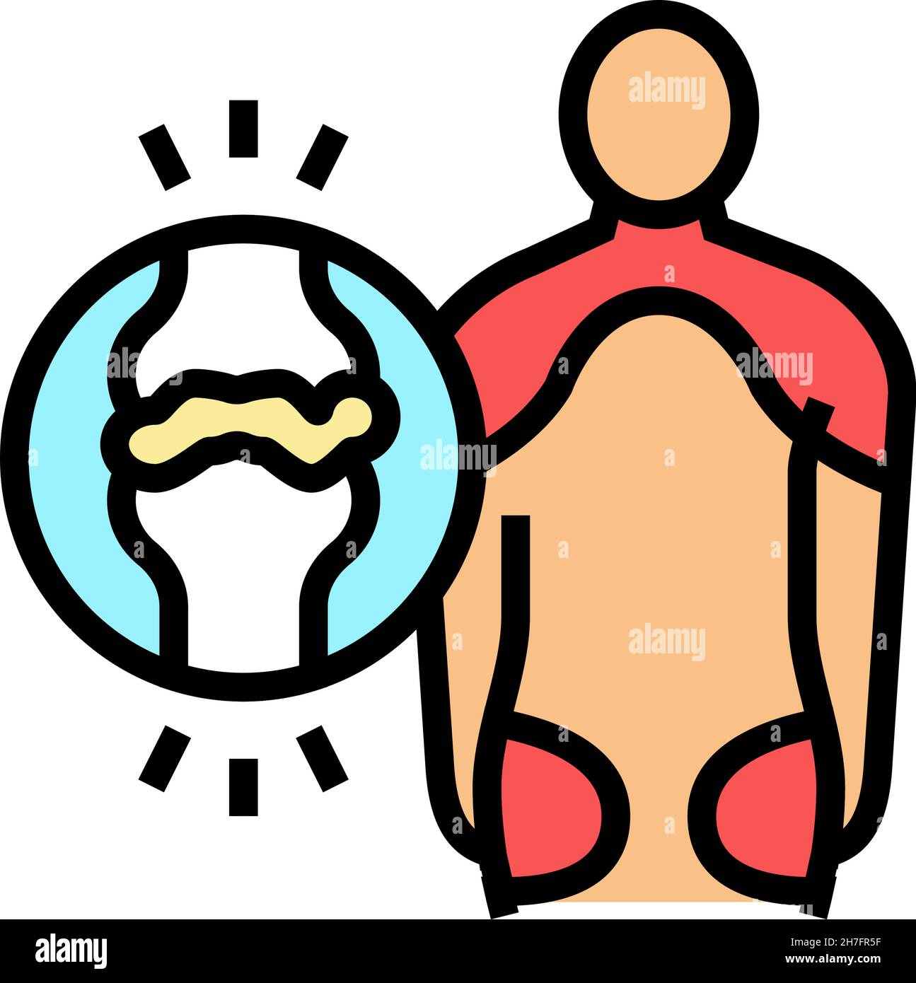 polymyalgia rheumatica color icon vector illustration Stock Vector ...