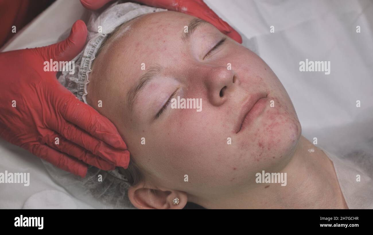 Applying powder to the client's face and massage the client's problem ...