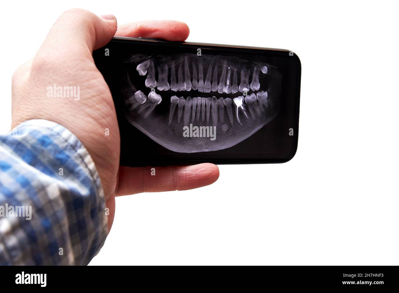 Man's hand with a cellphone with an Xray orthodontic picture of his jaw ...