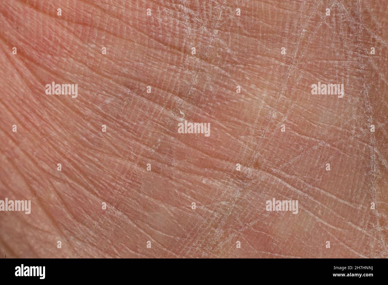 dried skin on had palm, macro texture Stock Photo - Alamy
