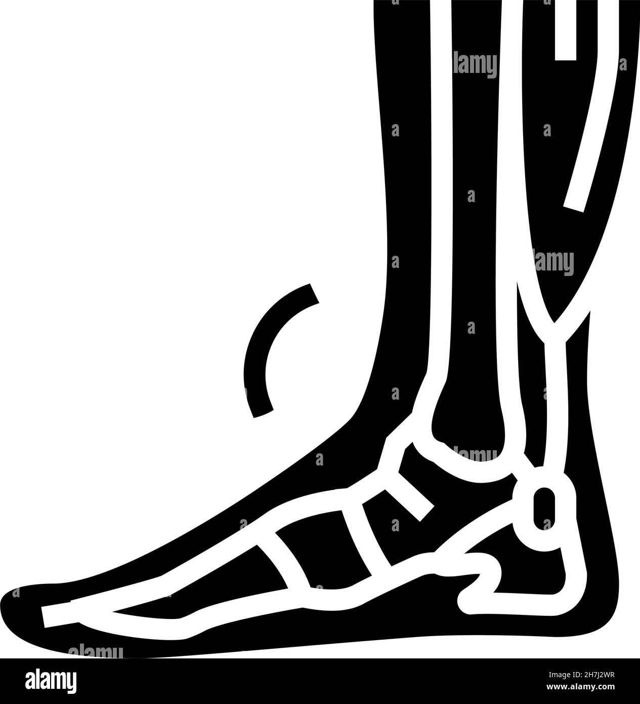 tendonitis problem glyph icon vector illustration Stock Vector Image ...