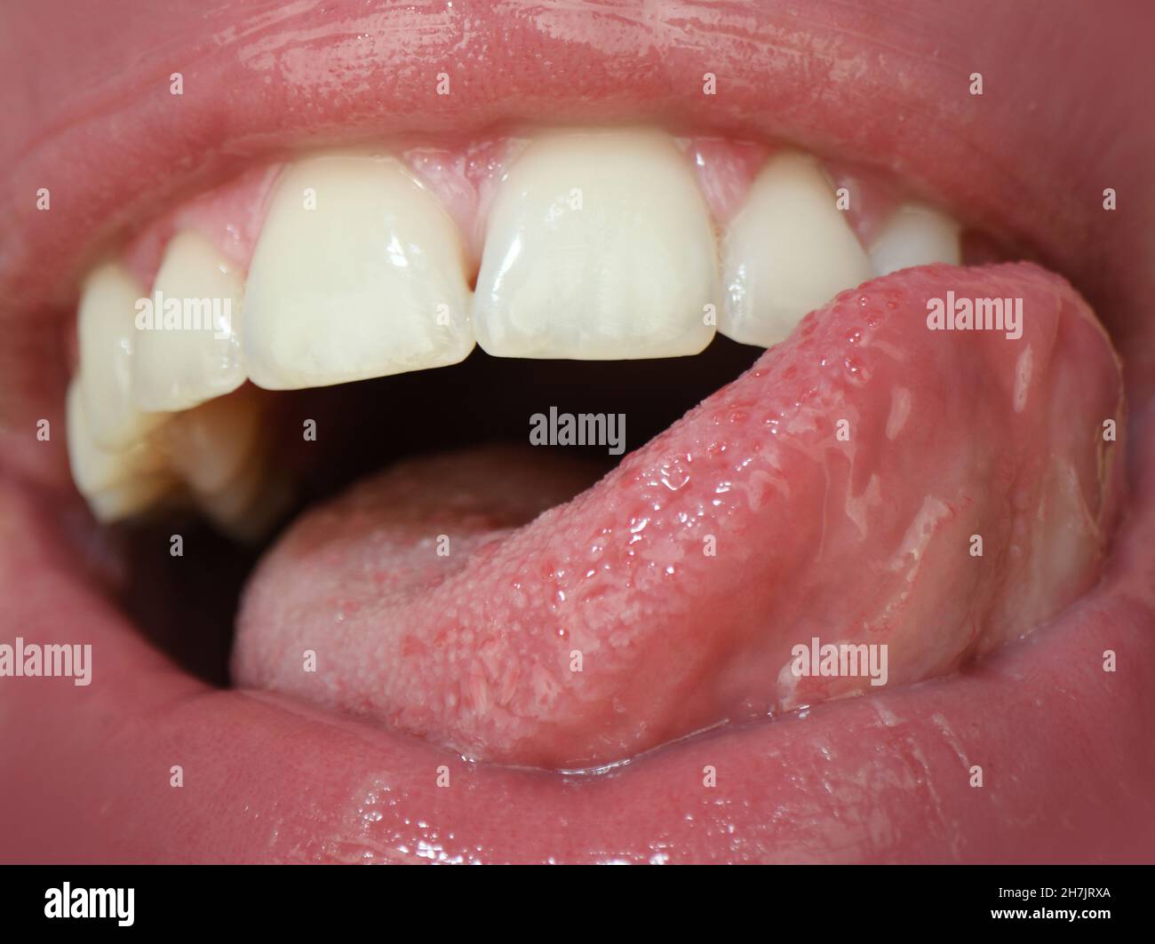 Dental care, healthy teeth and smile, white teeth in mouth. Closeup of ...