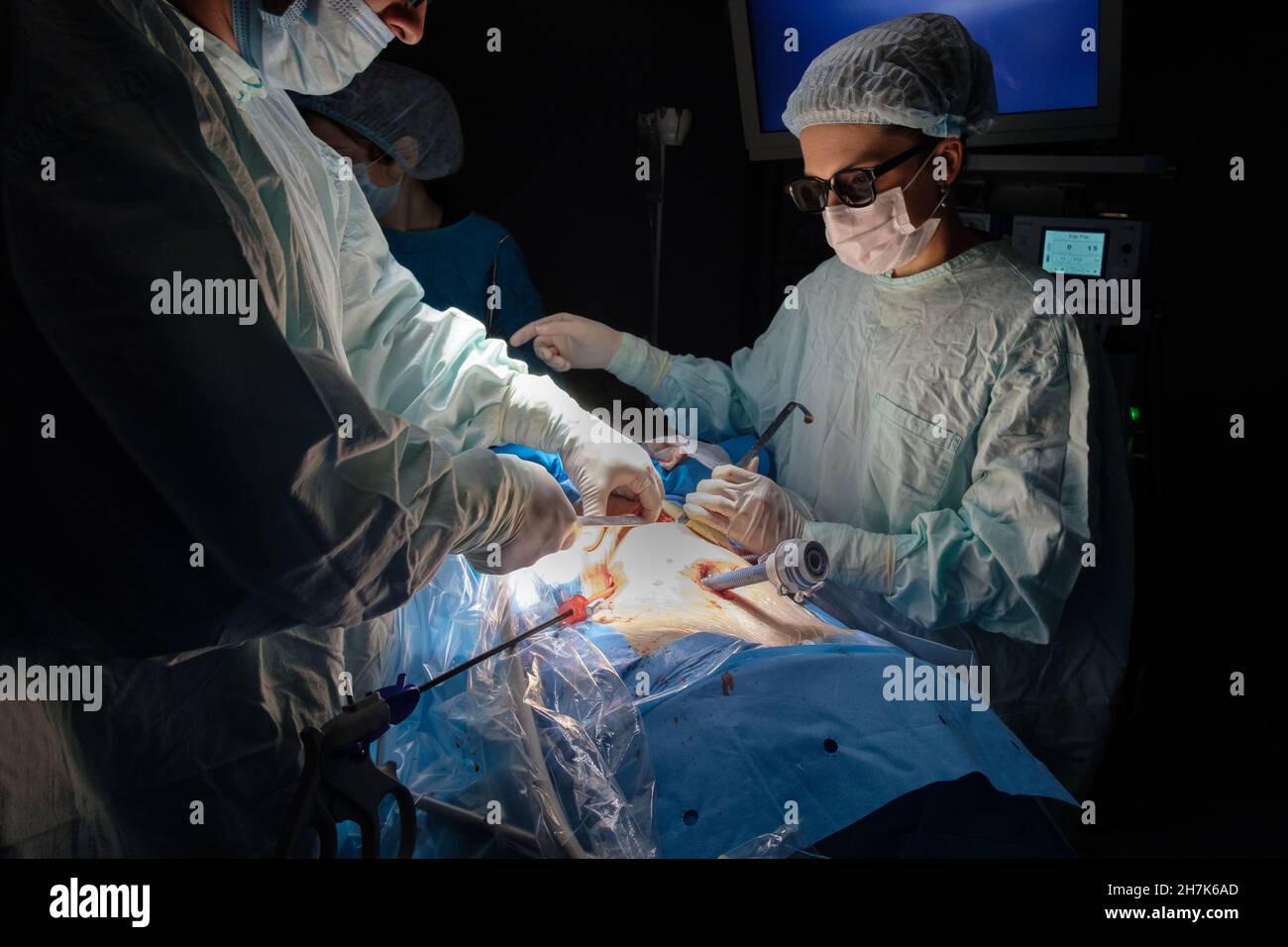 A female surgeon wearing 3D glasses operates on a patient. Trocar tubes ...