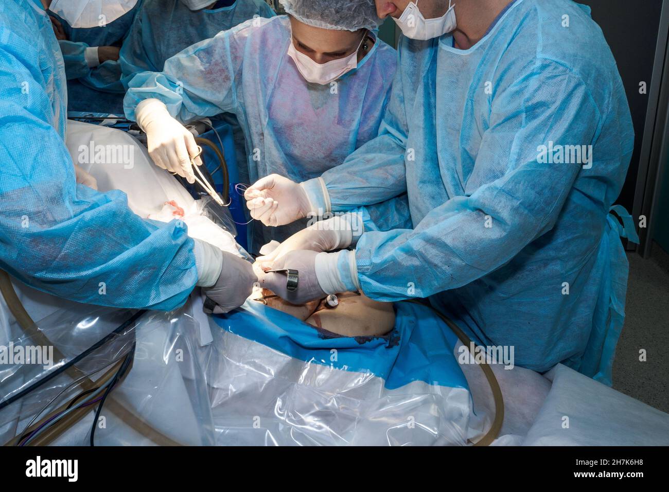 A team of surgeons stitches the patient's skin using a needle holder ...
