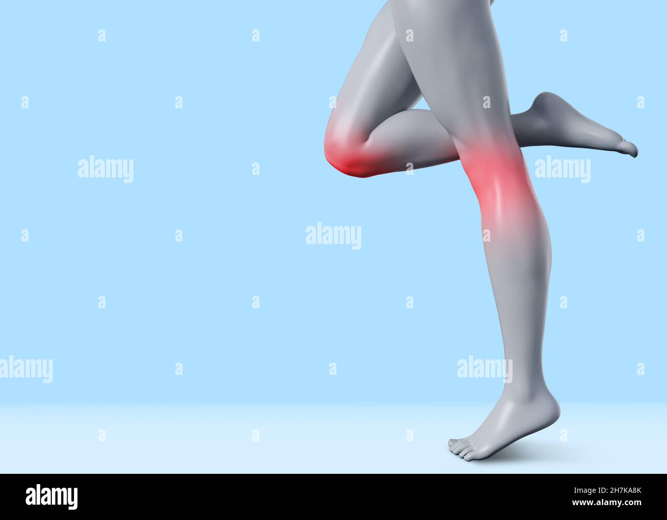 3d render illustration of female legs standing with knee pain area on ...