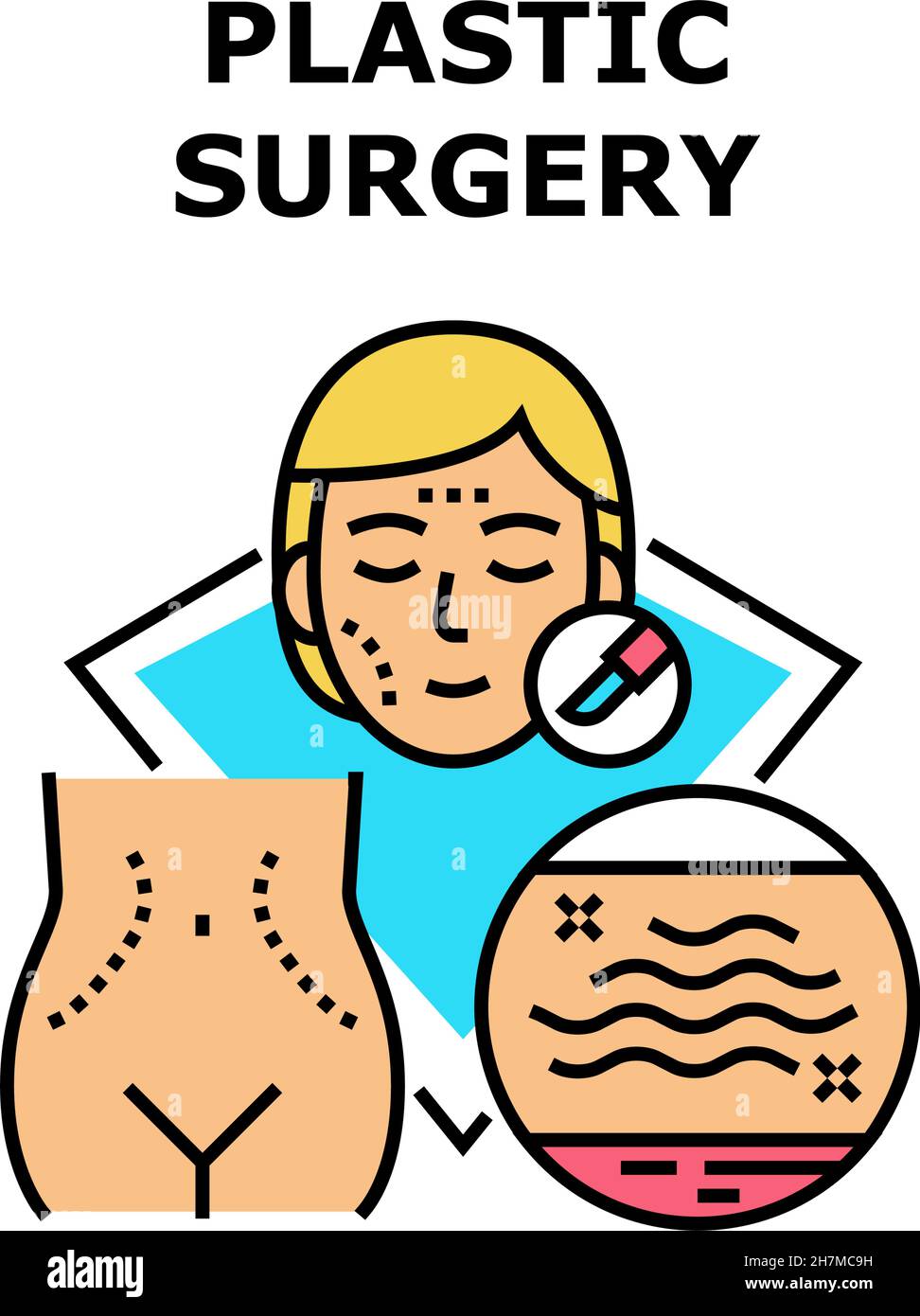 Plastic Surgery Vector Concept Color Illustration Stock Vector Image ...