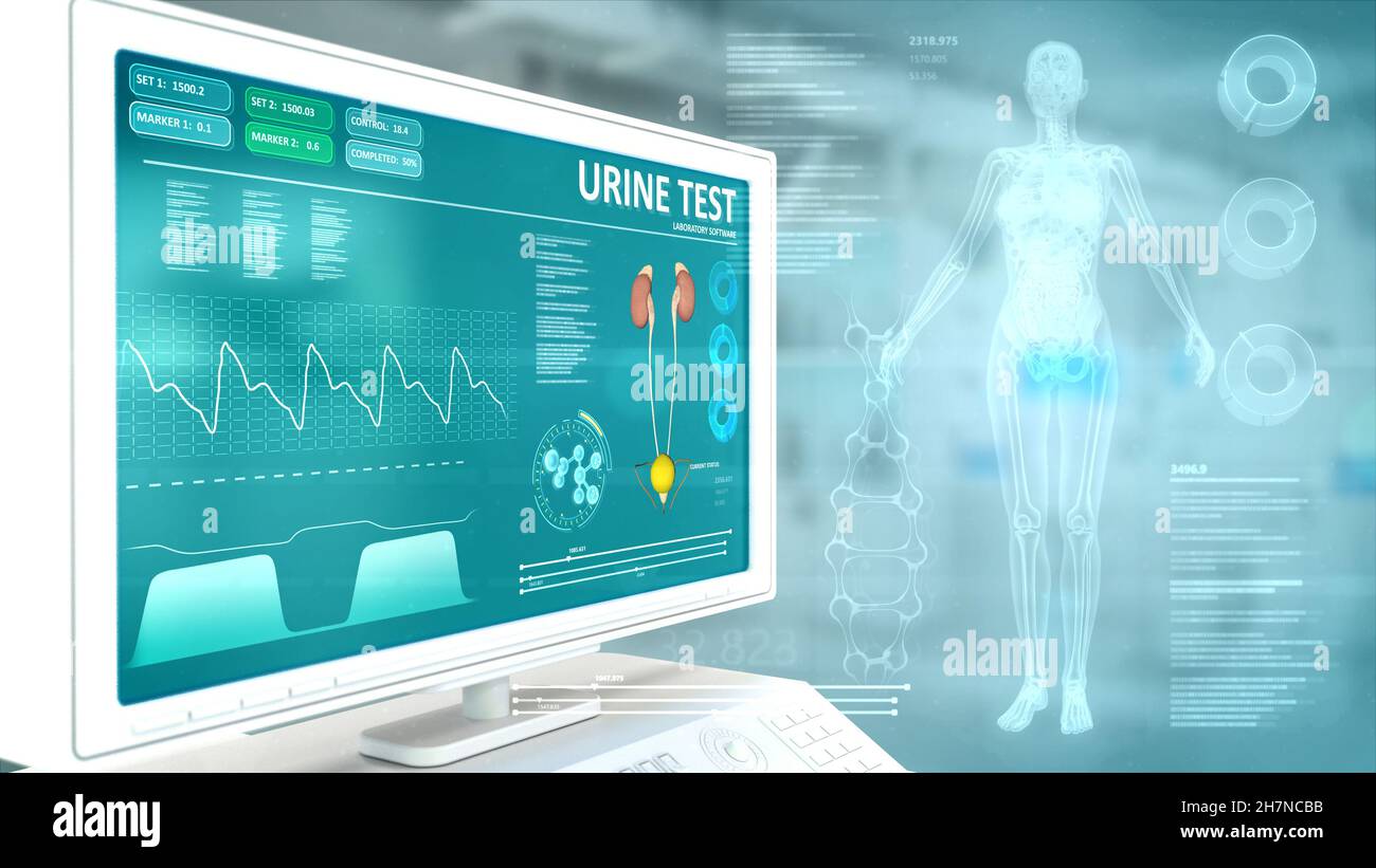 urine test - female health composition with overlays - cgi industrial ...
