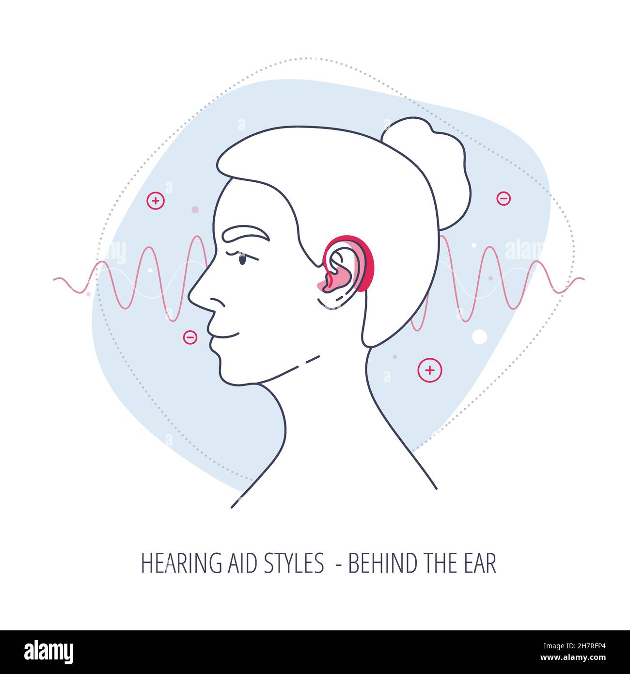 A woman's head with behind the ear aid,hearing aid style for the ...