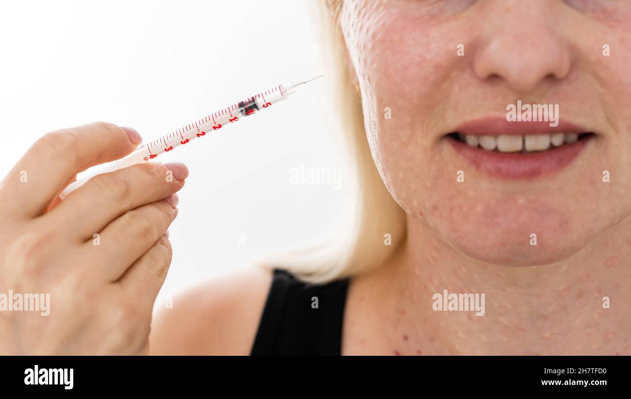 Real skin Biorevitalization on white background. Traces of ...