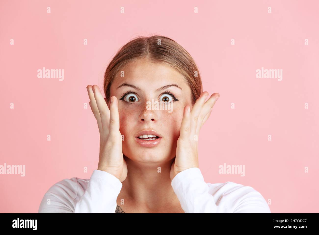 Pink freckles hi-res stock photography and images - Alamy