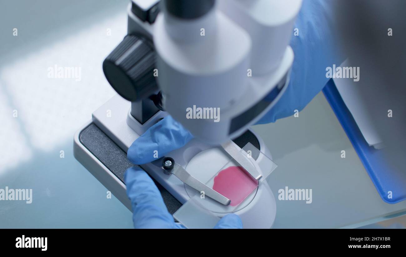 Closeup of scientist doctor hand adjusting medical microscope analyzing slide with blood sample ...