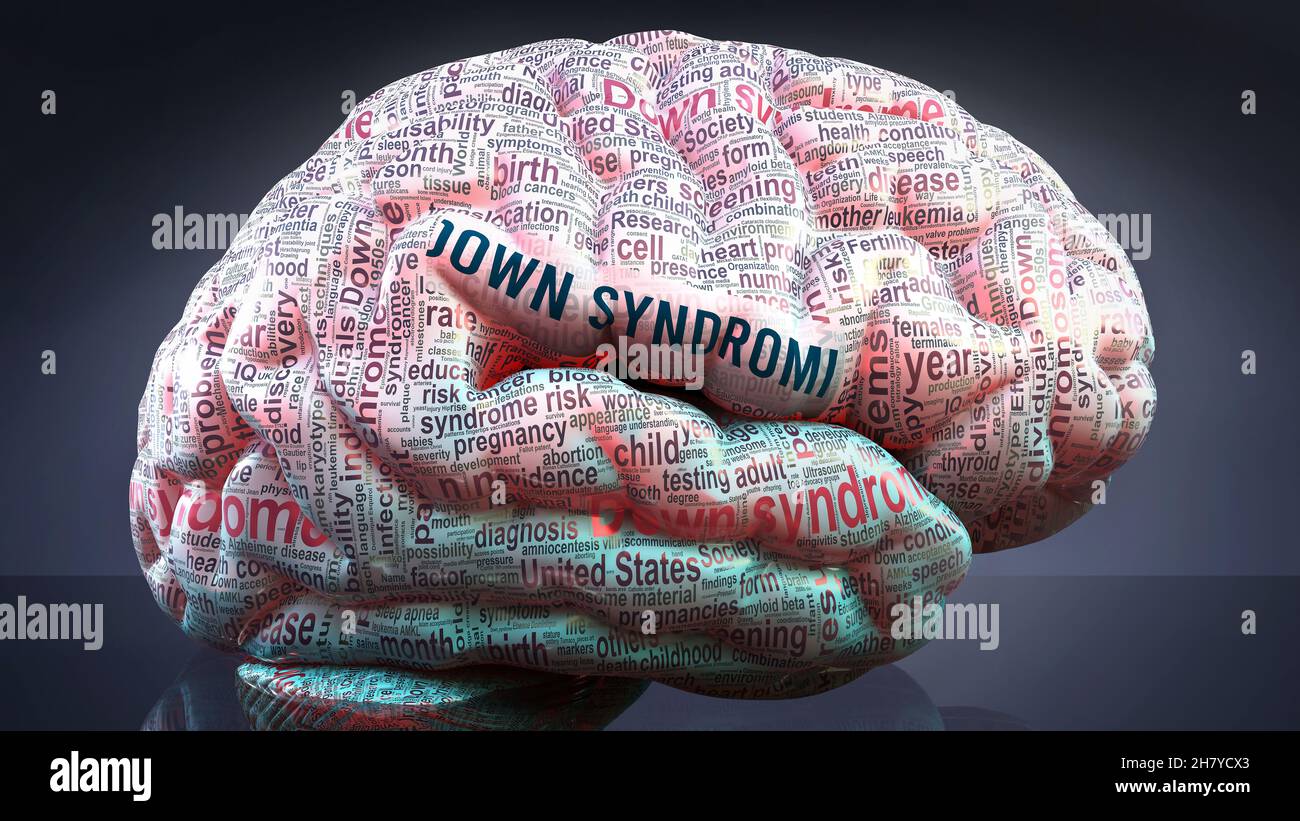 Down syndrome in human brain hi-res stock photography and images - Alamy