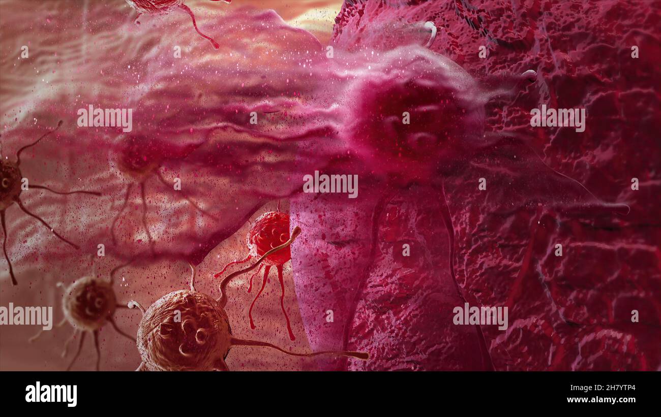 3d illustration - damaged and disintegrating cancer cell Stock Photo ...