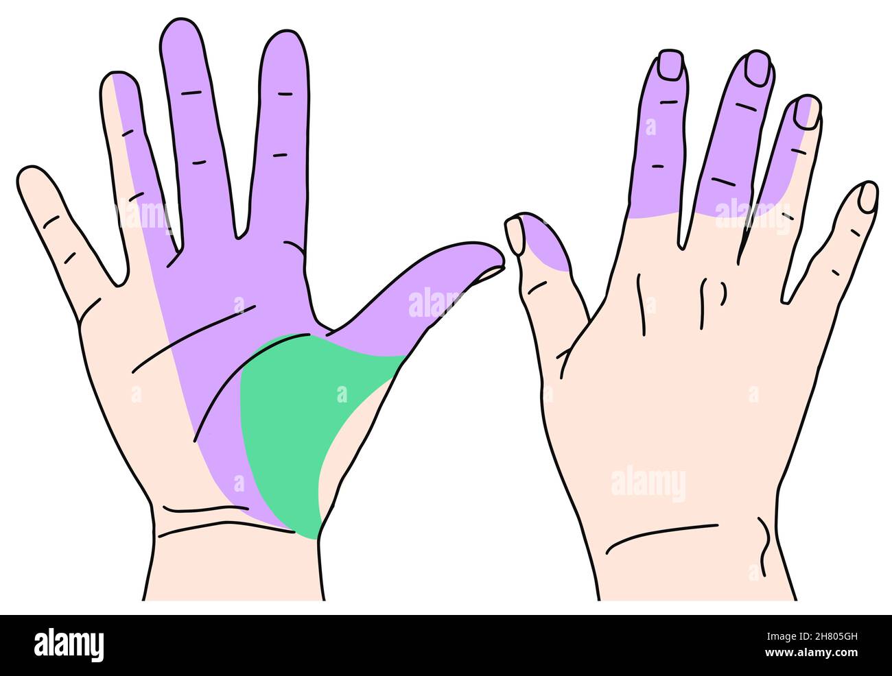 Median Nerve Distribution