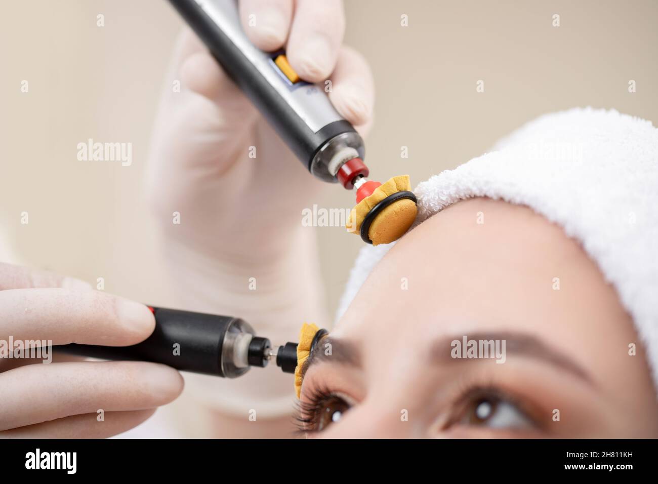 Therapy Microcurrent procedure spa vs acne. Beautiful woman receiving ...