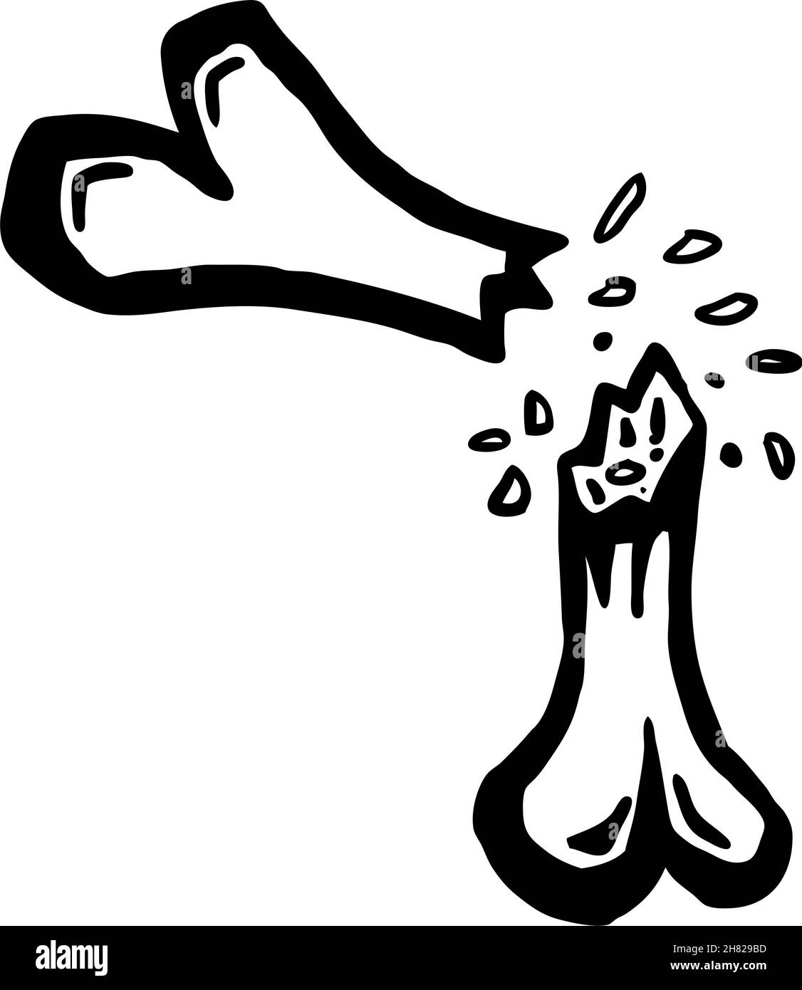 Painted broken bone, vector illustration Stock Vector Image & Art - Alamy