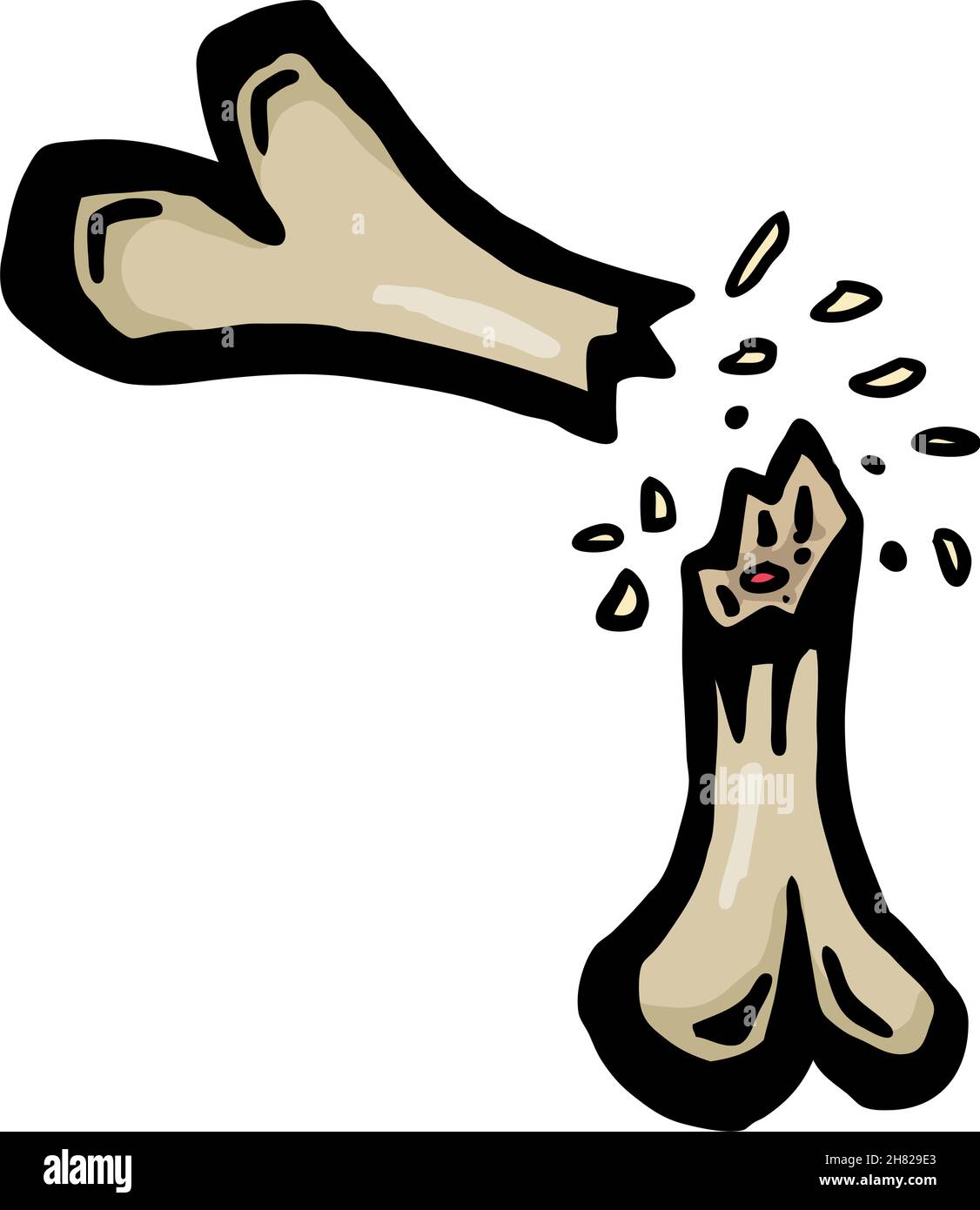 Painted broken bone, vector illustration Stock Vector Image & Art - Alamy