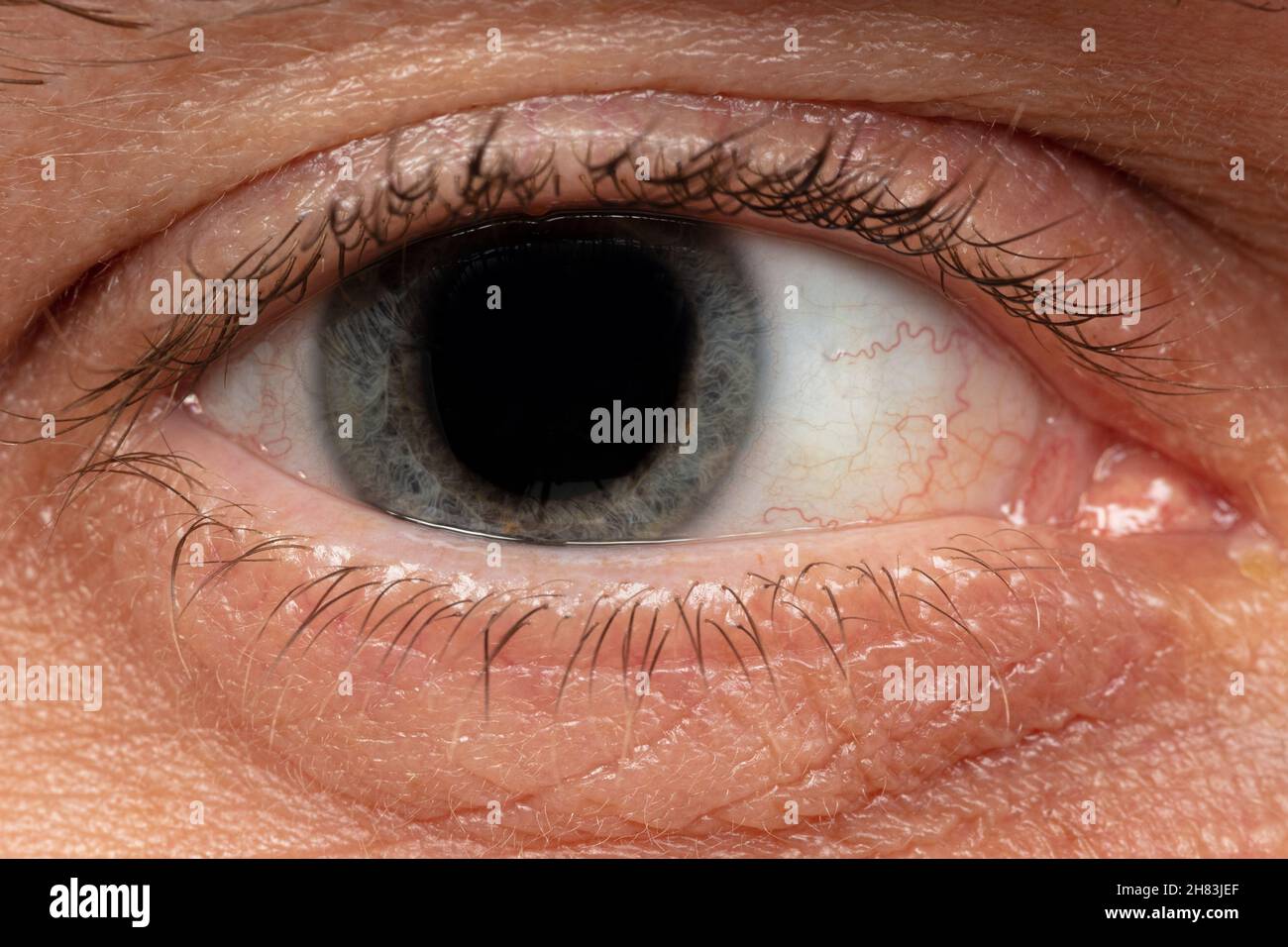 wide open human eye close up Stock Photo - Alamy