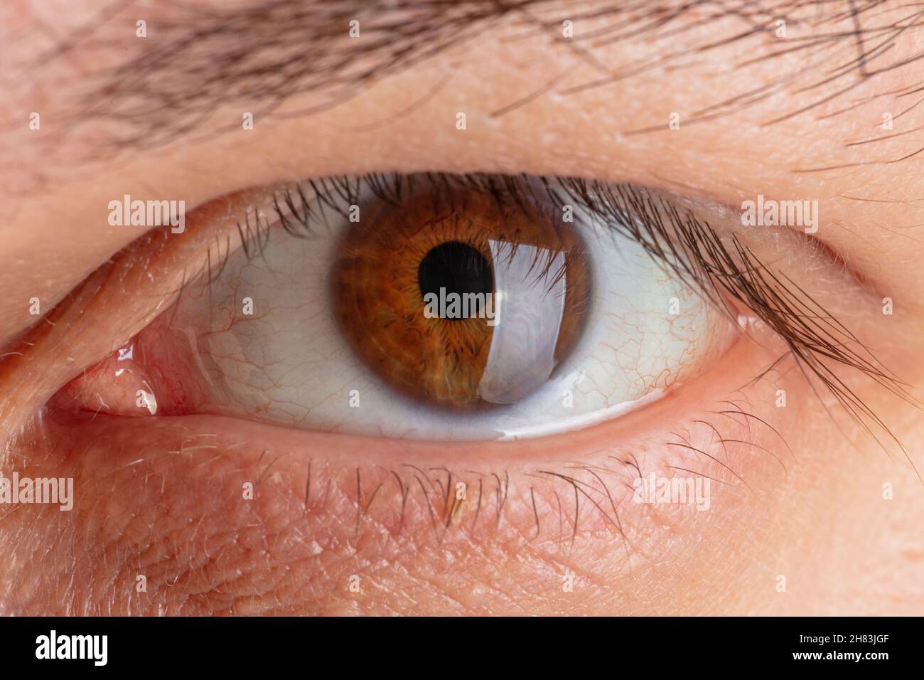 wide open human eye close up Stock Photo - Alamy