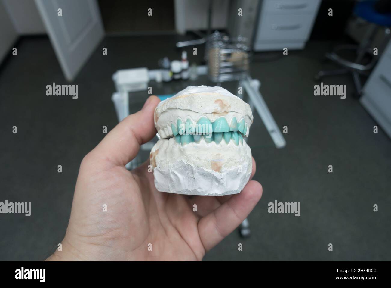 modeling of artificial teeth on a plaster model for visual display ...