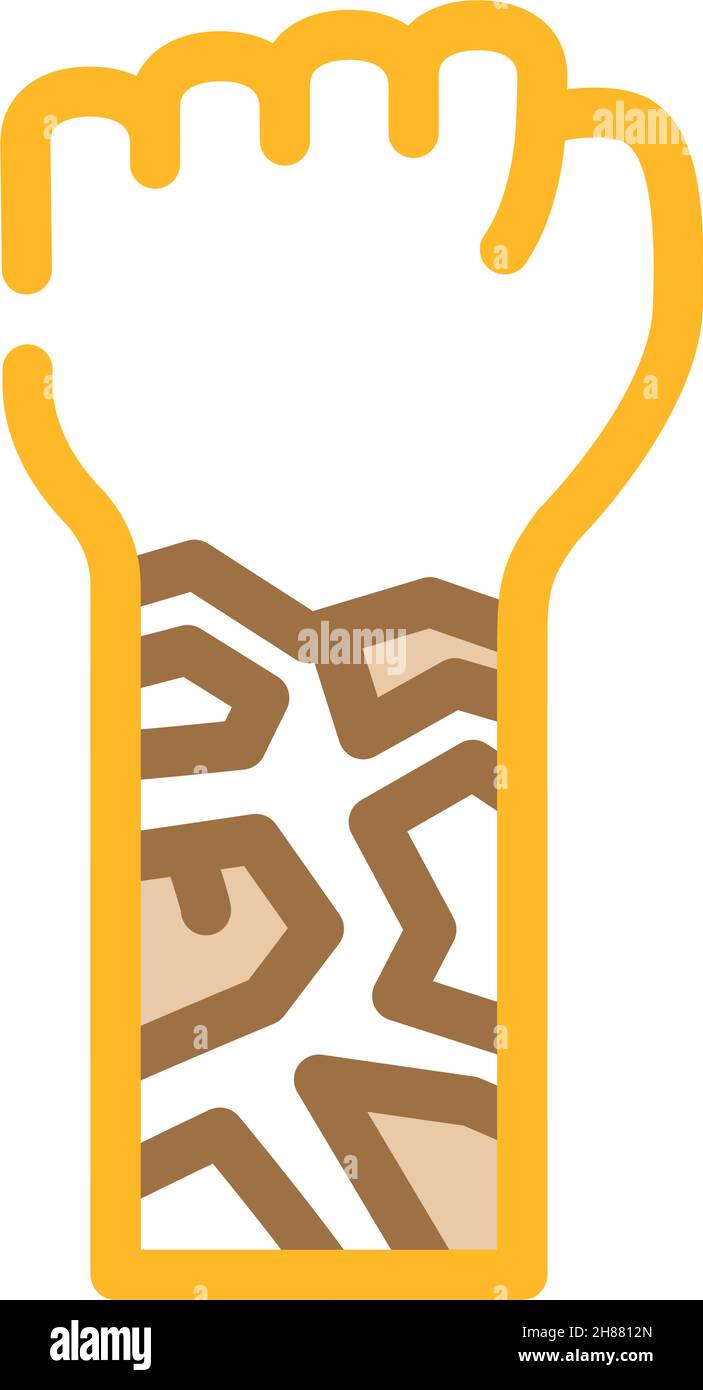 Ichthyosis Skin Disease Color Icon Vector Illustration Stock Vector