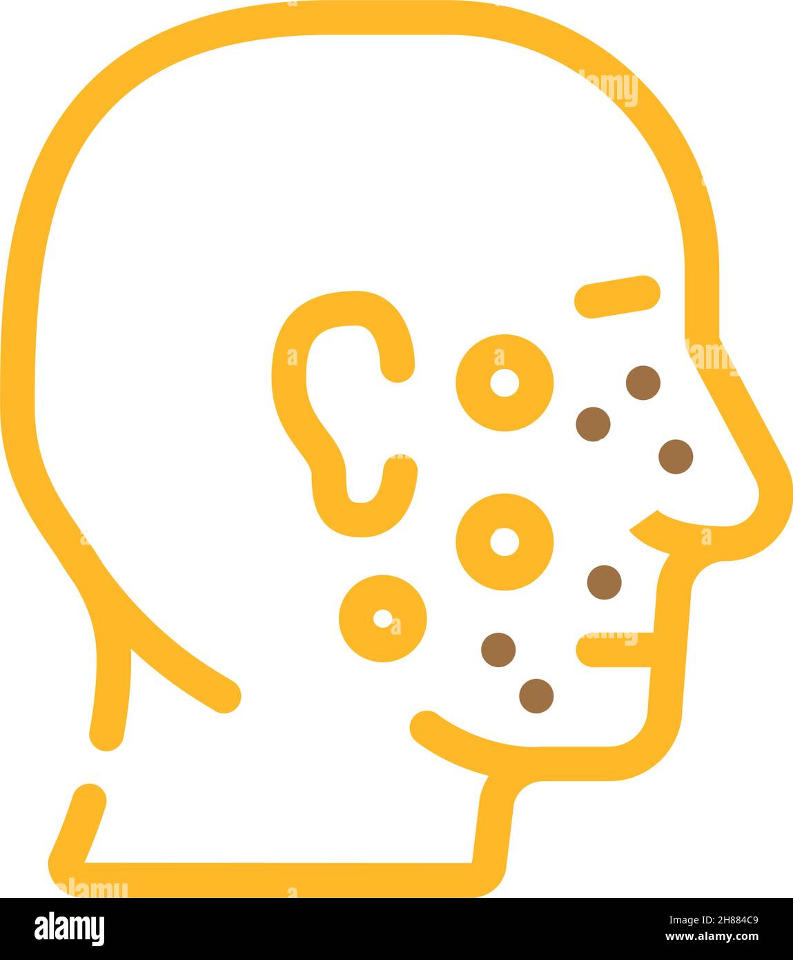 acne facial skin disease color icon vector illustration Stock Vector ...