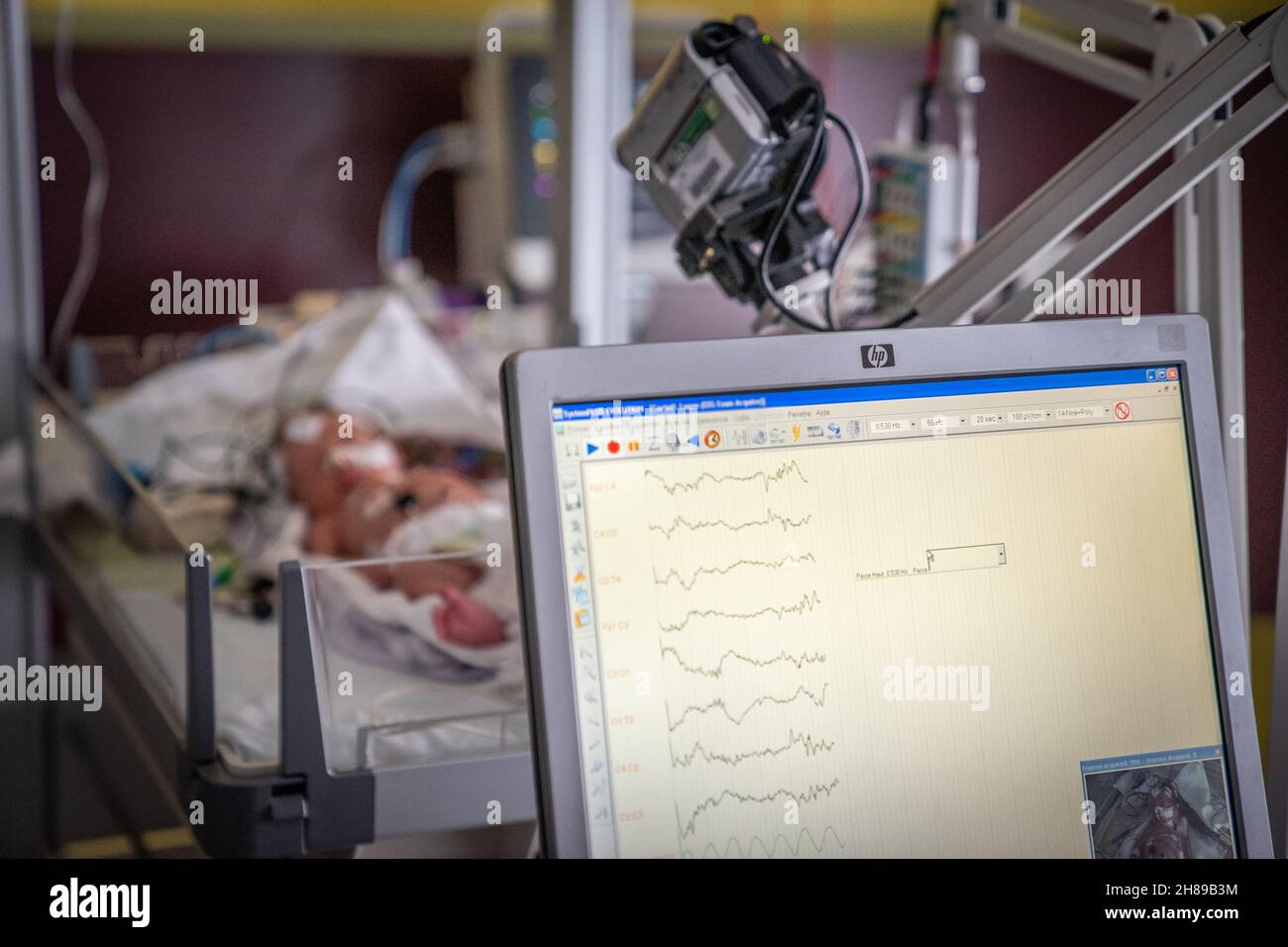 Electroencephalogram child hi-res stock photography and images - Alamy