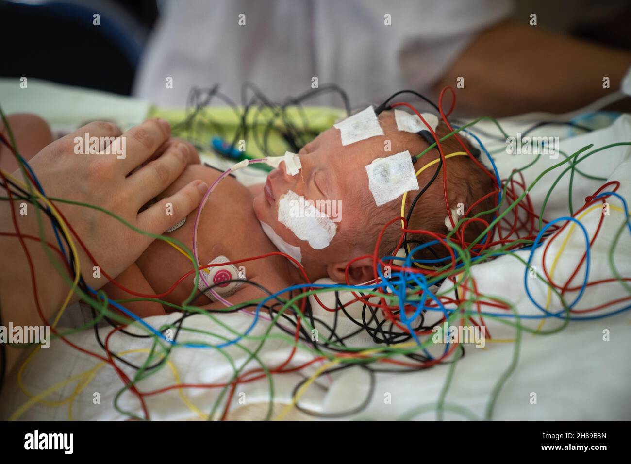 Encephalogram hi-res stock photography and images - Alamy