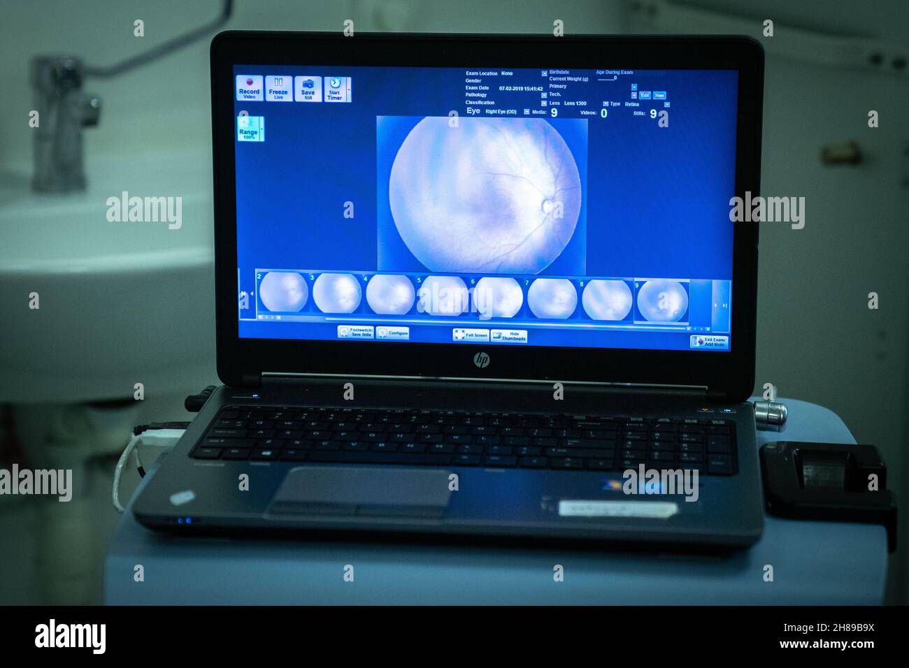 Facial imaging hi-res stock photography and images - Alamy