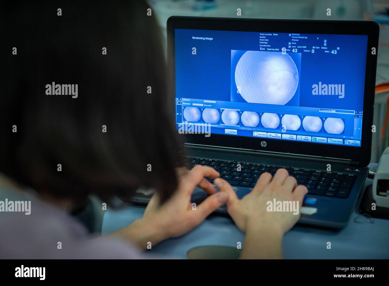 Fundus imaging hi-res stock photography and images - Alamy