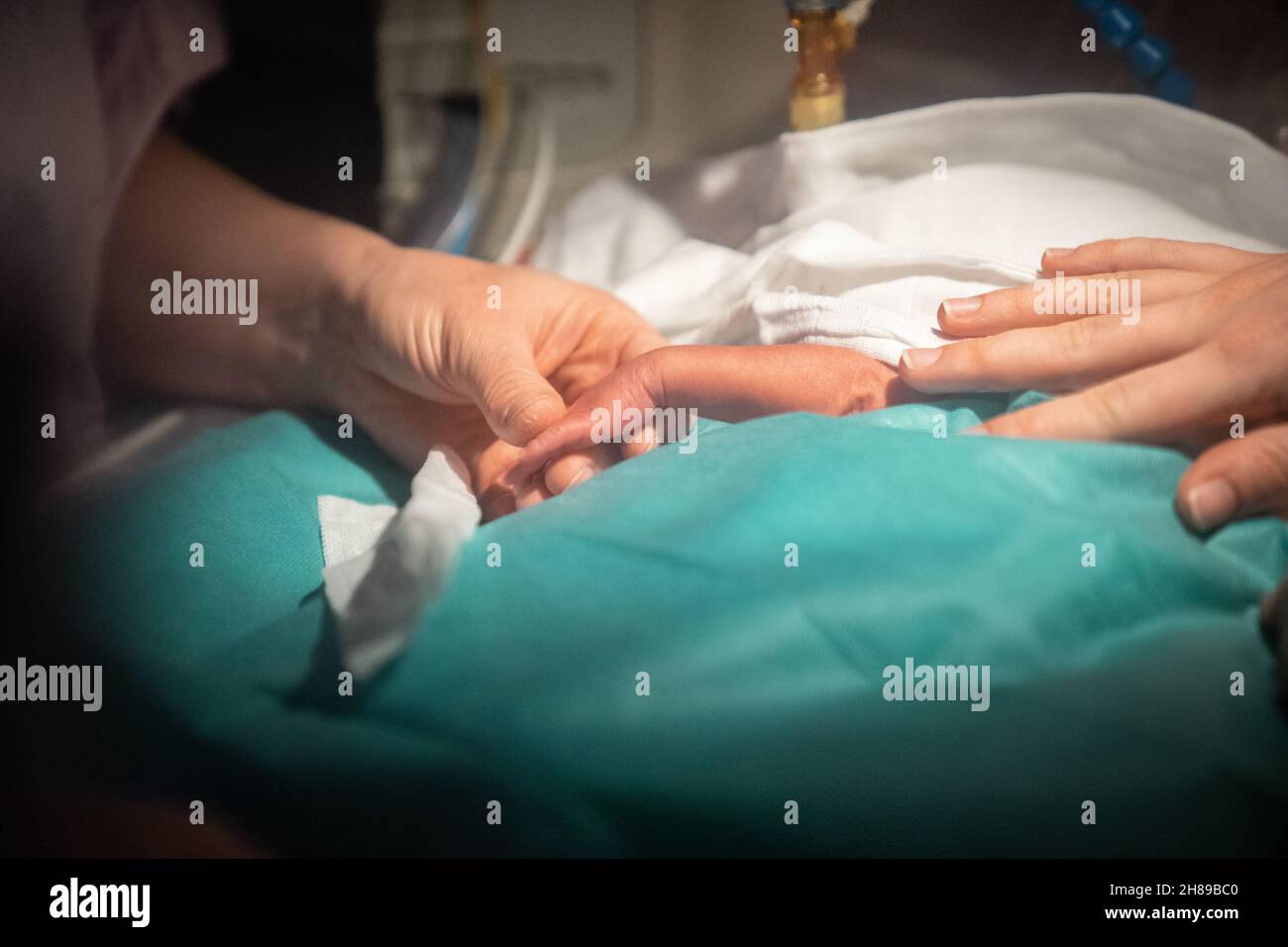 Blood sampling baby hi-res stock photography and images - Alamy