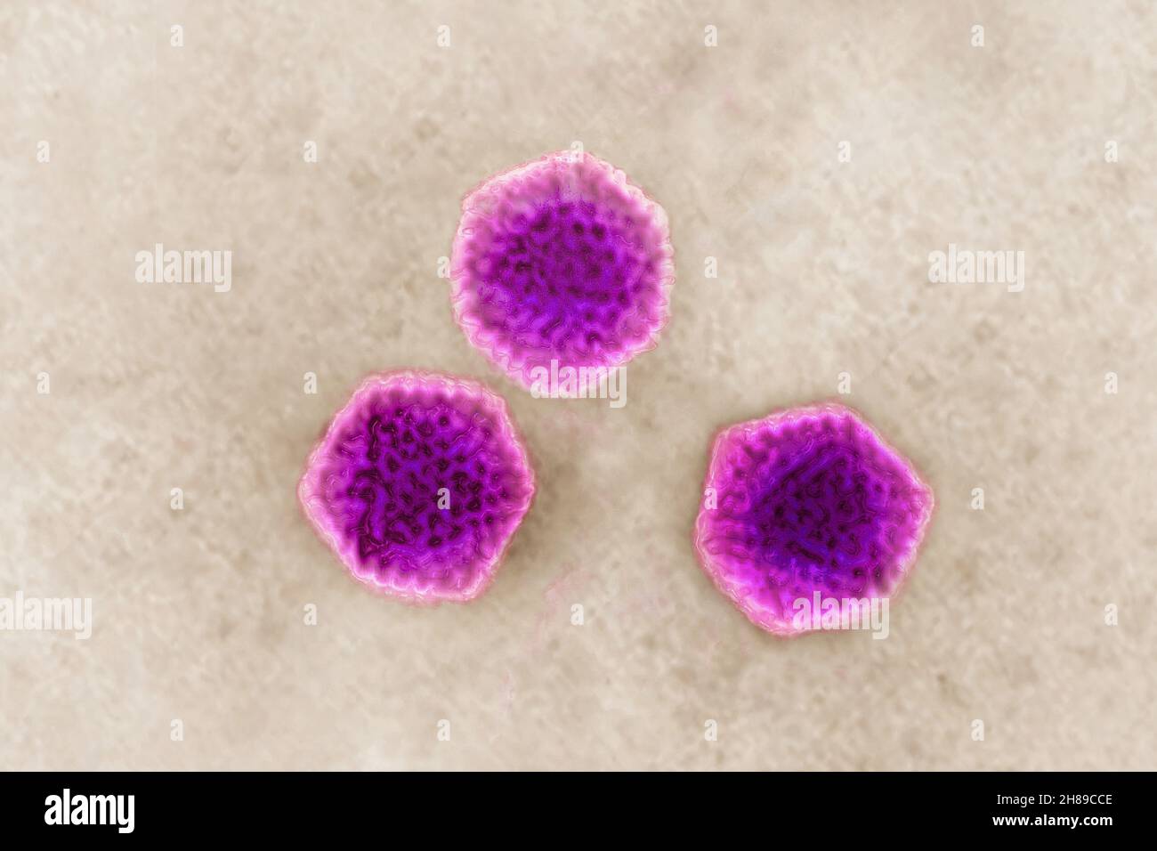 Conjunctivitis hi-res stock photography and images - Alamy