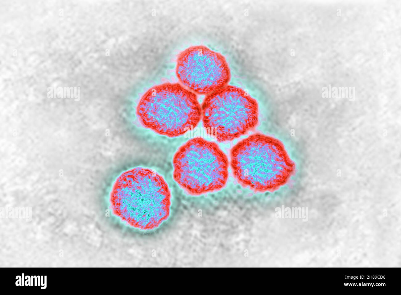 Dengue fever virus micrograph hi-res stock photography and images - Alamy