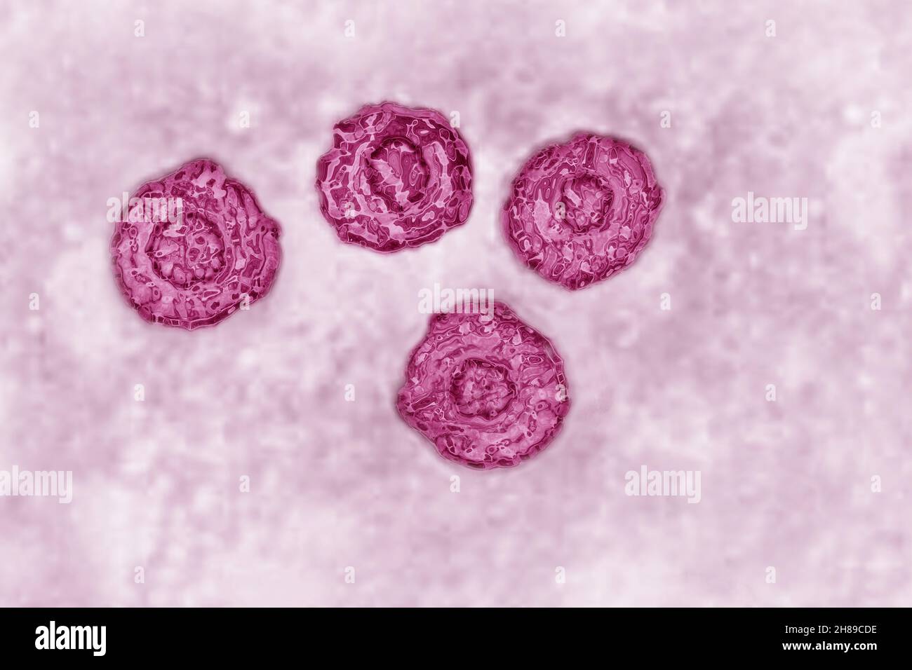 Hepatitis C Virus Microscope