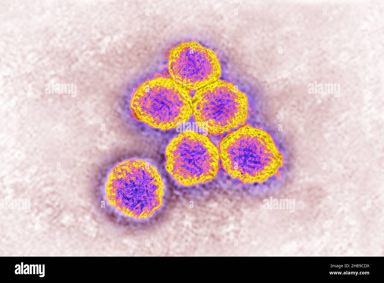 Dengue fever virus micrograph hi-res stock photography and images - Alamy