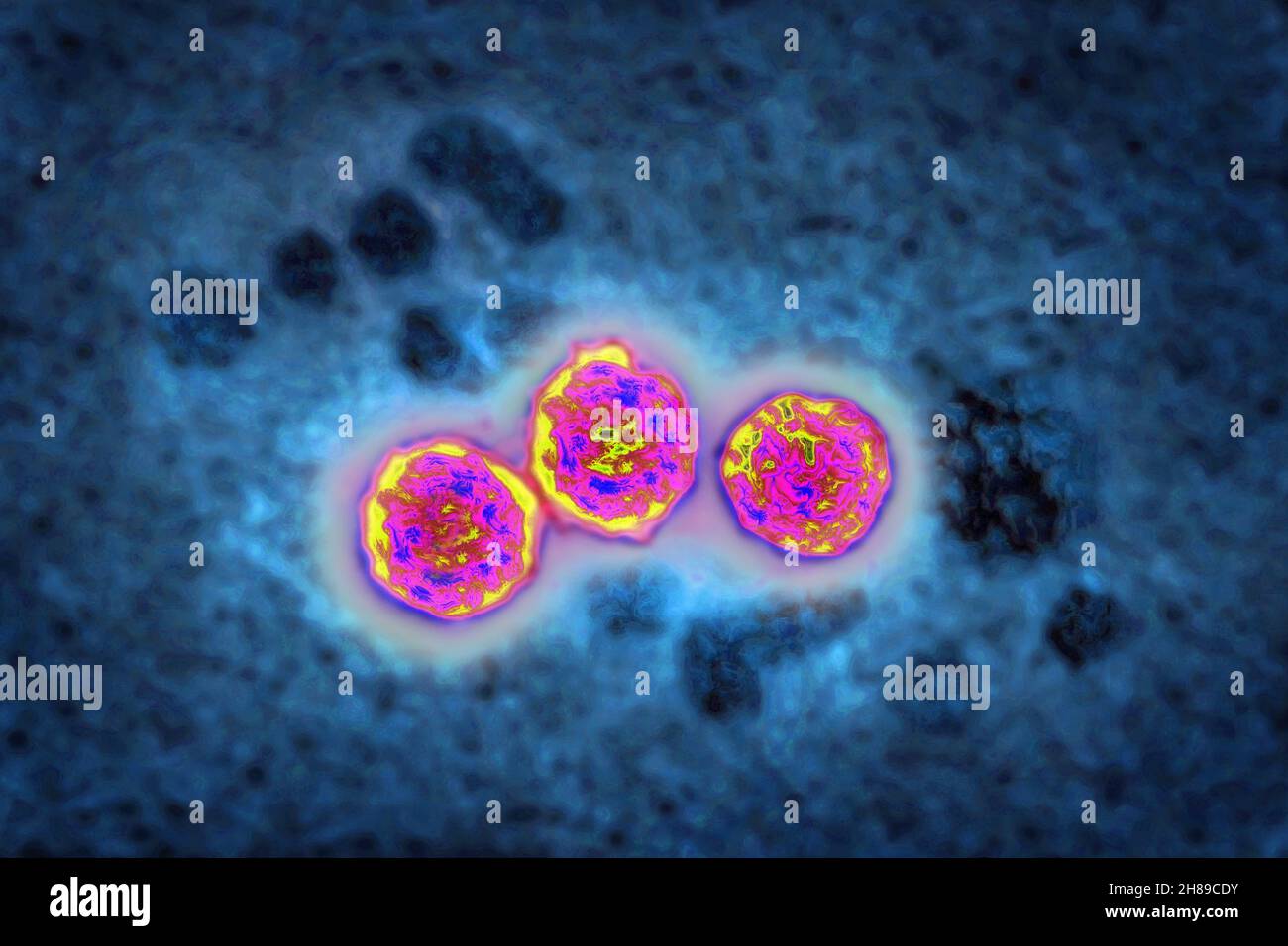 Hepatitis b virus Stock Photo - Alamy