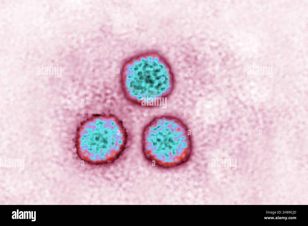 Human papillomavirus micrograph hi-res stock photography and images - Alamy