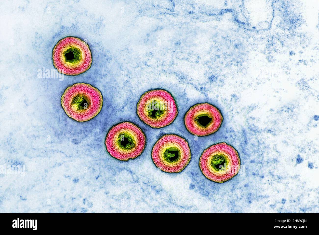 Herpesviridae hi-res stock photography and images - Alamy