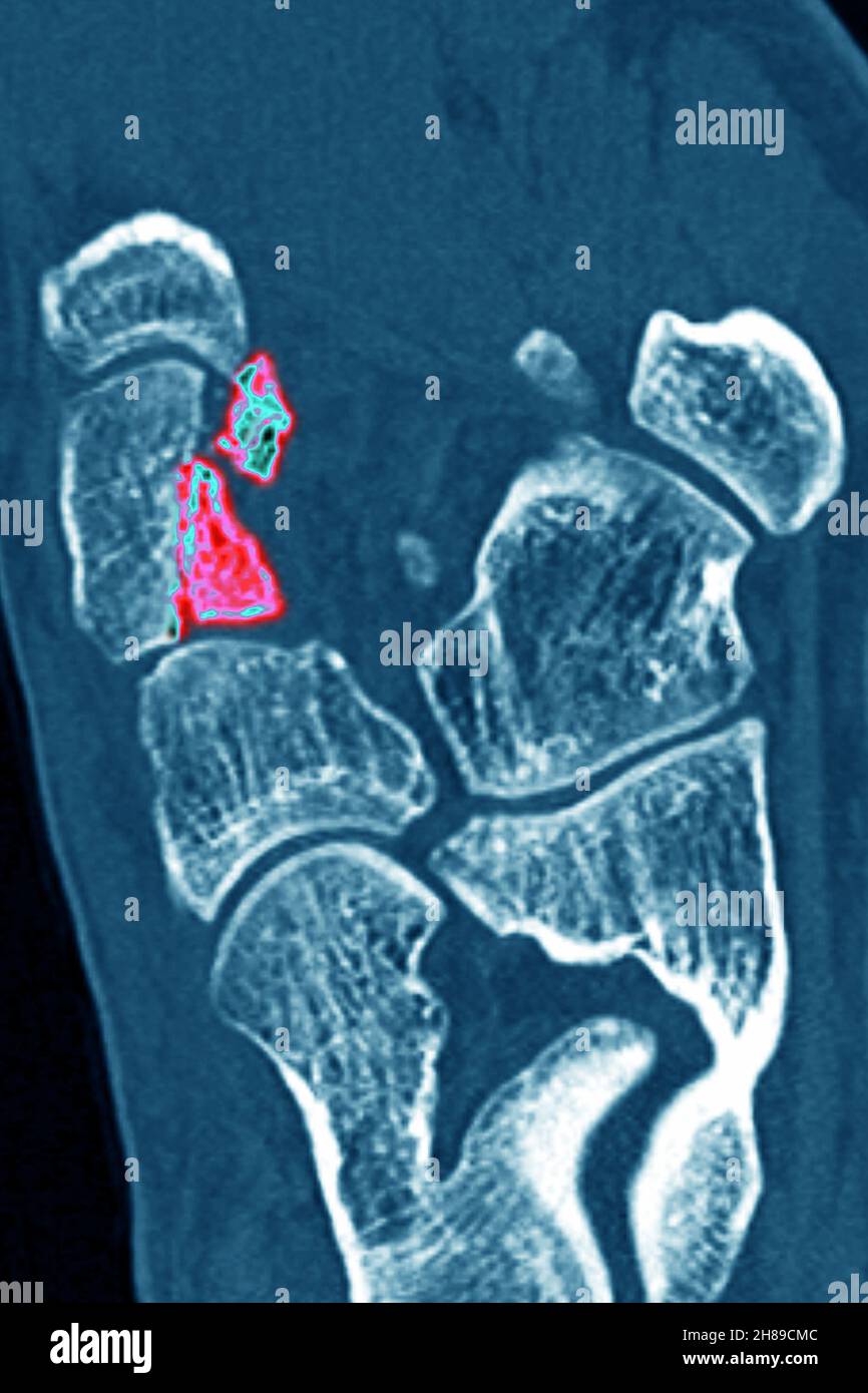 Medical trauma hi-res stock photography and images - Alamy