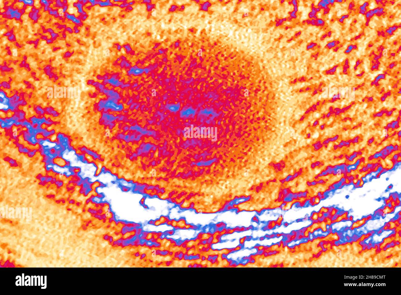 Human testicle hi-res stock photography and images - Alamy