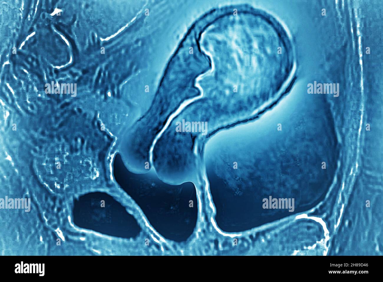 Uterus Scan High Resolution Stock Photography and Images - Alamy