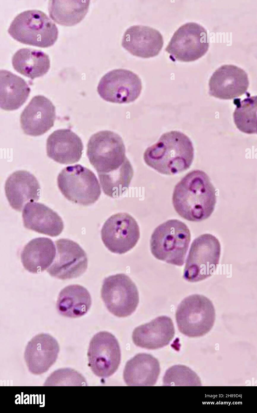 Plasmodium falciparum microscope hi-res stock photography and images ...
