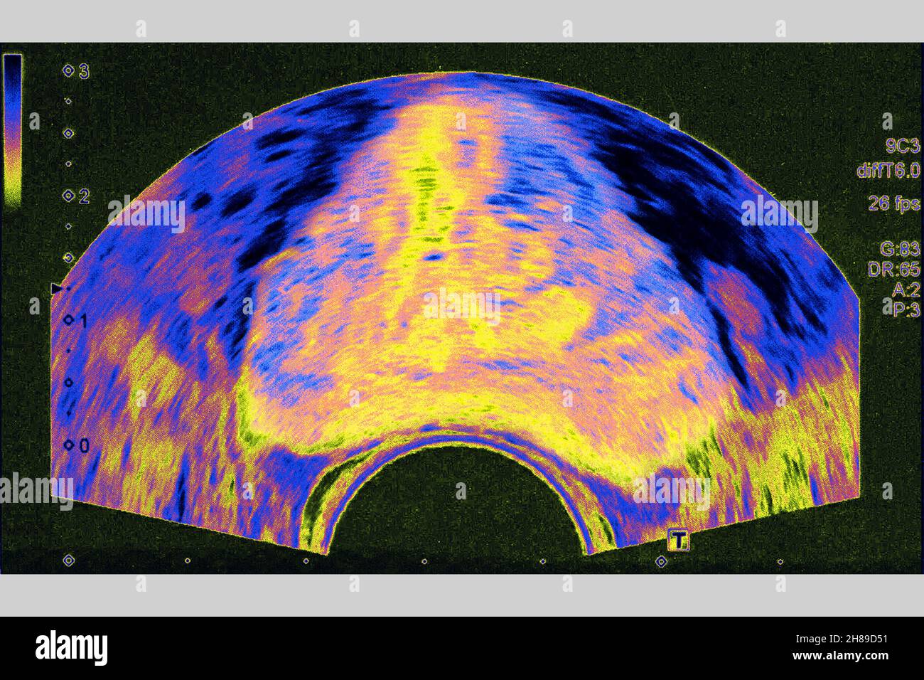 Ultrasound examination hi-res stock photography and images - Alamy