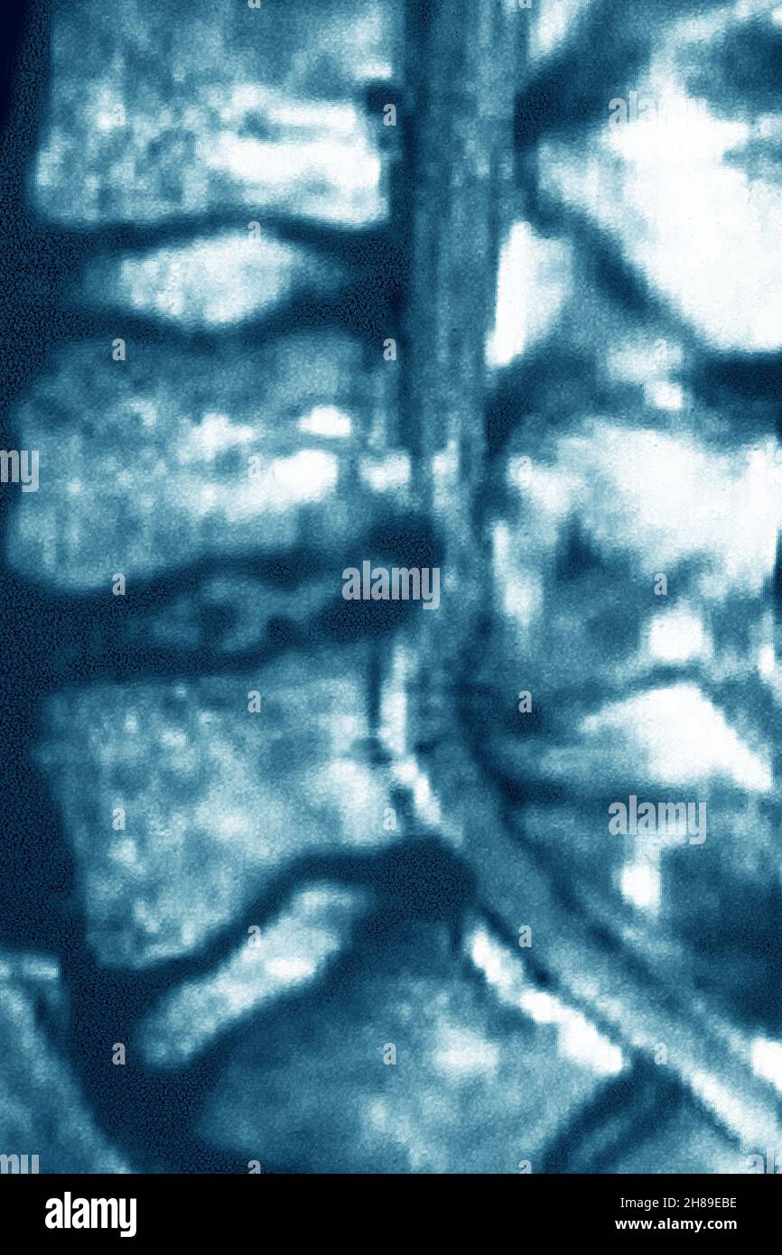 Individual disc hi-res stock photography and images - Alamy