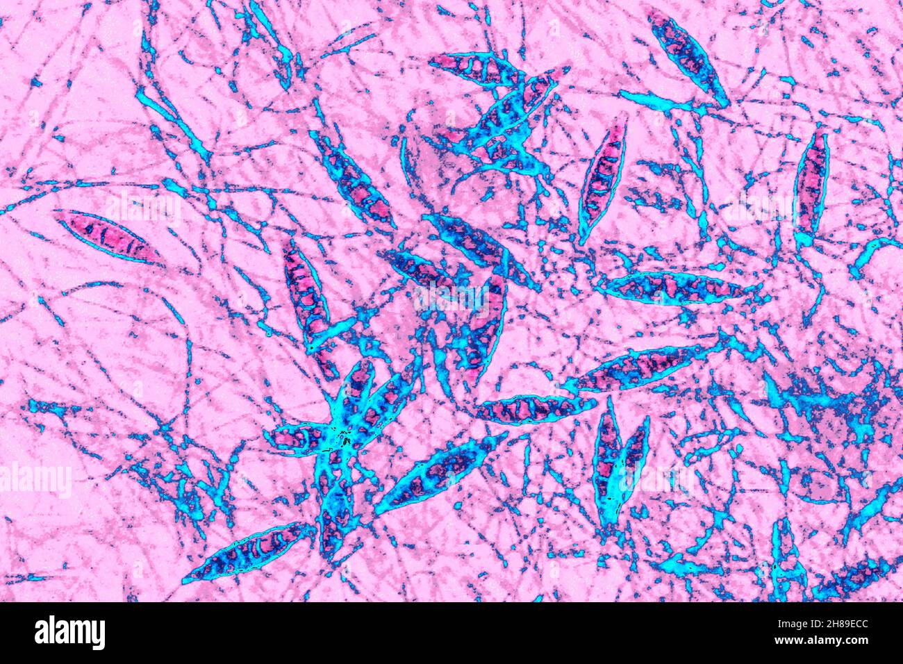 Microsporum canis fungi hi-res stock photography and images - Alamy