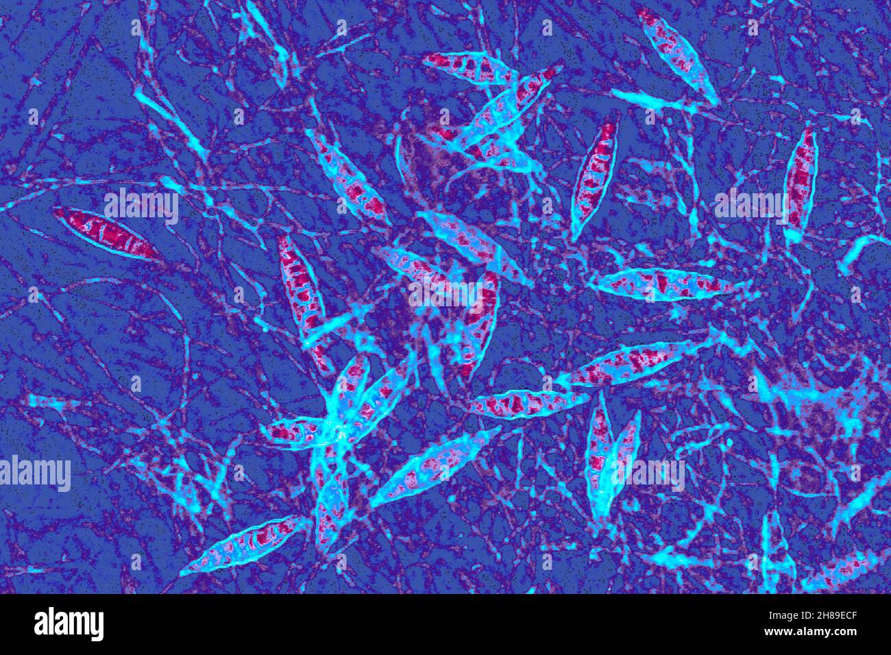 Microsporium hi-res stock photography and images - Alamy