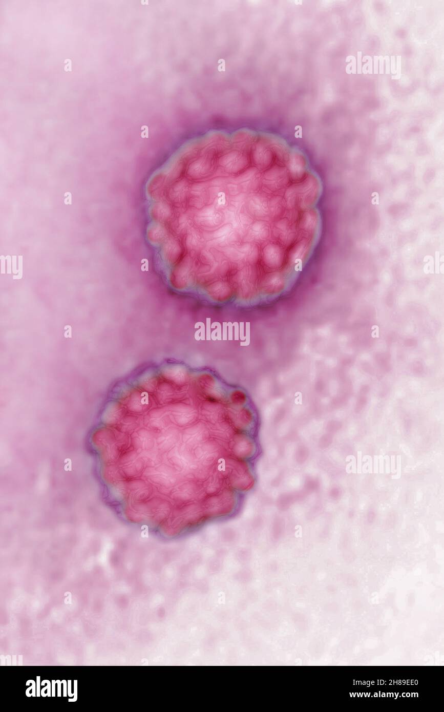 Human papillomavirus micrograph hi-res stock photography and images - Alamy